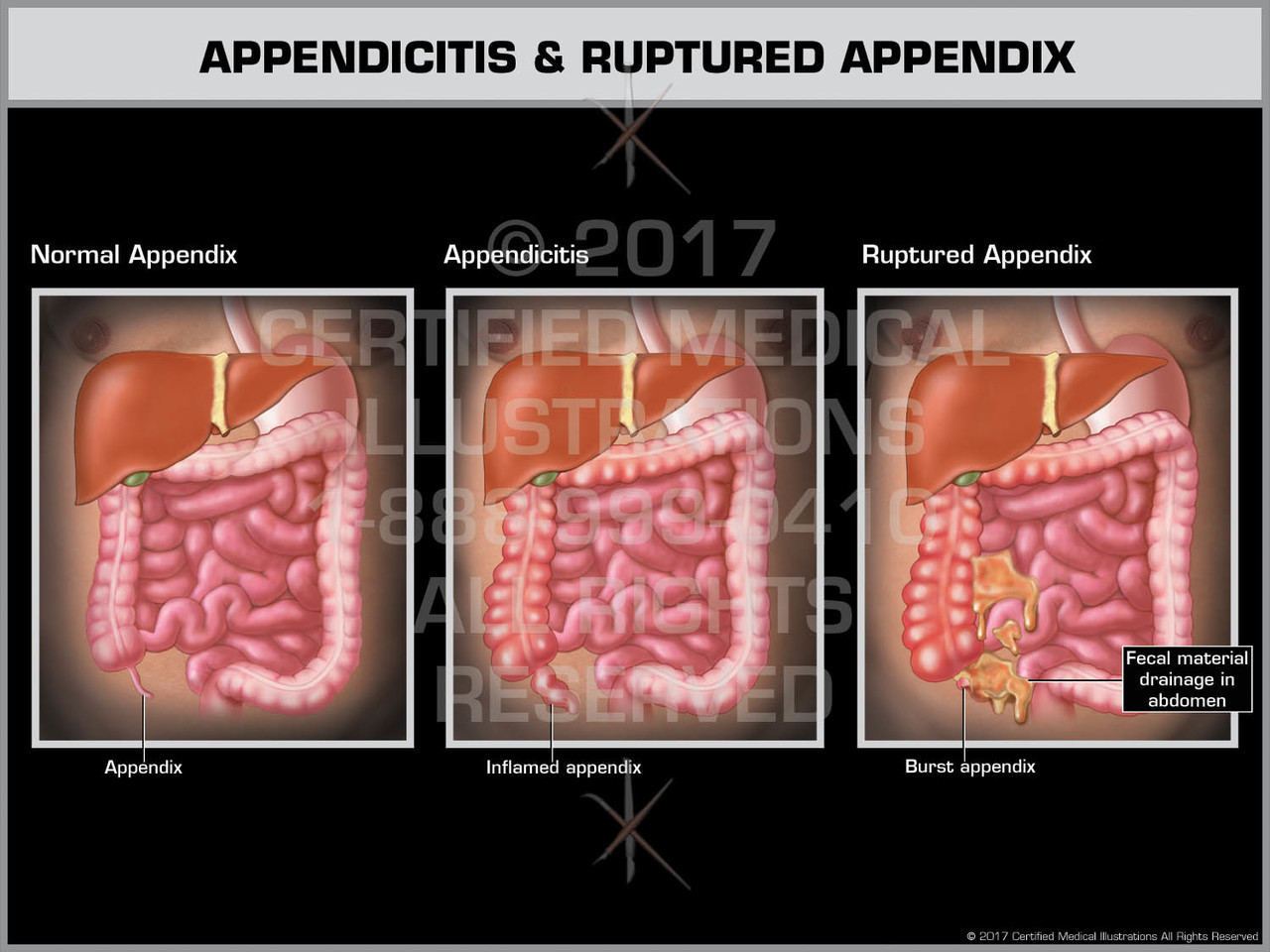Appendices Or Appendixes