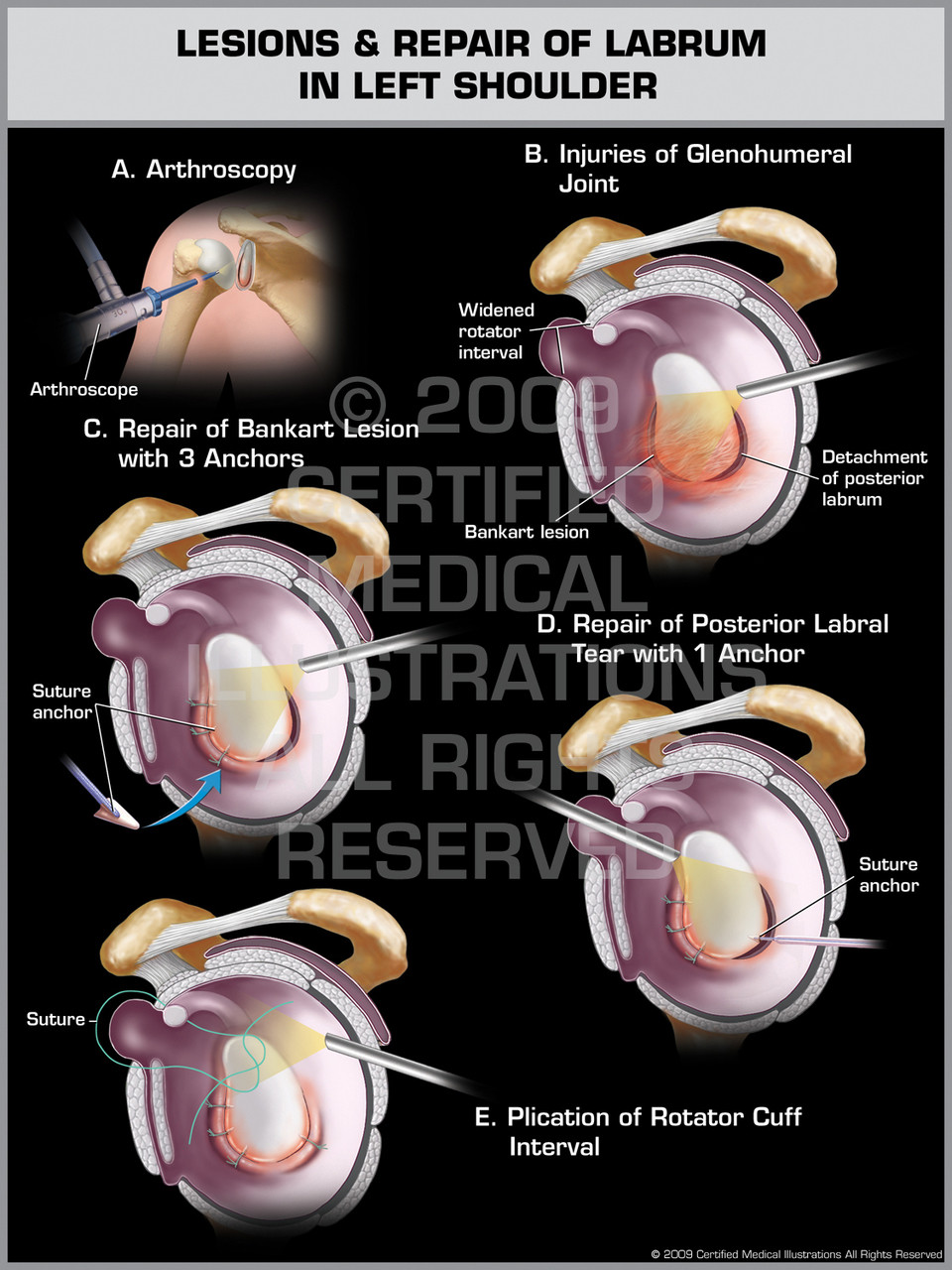 Shoulder Labrum Anatomy