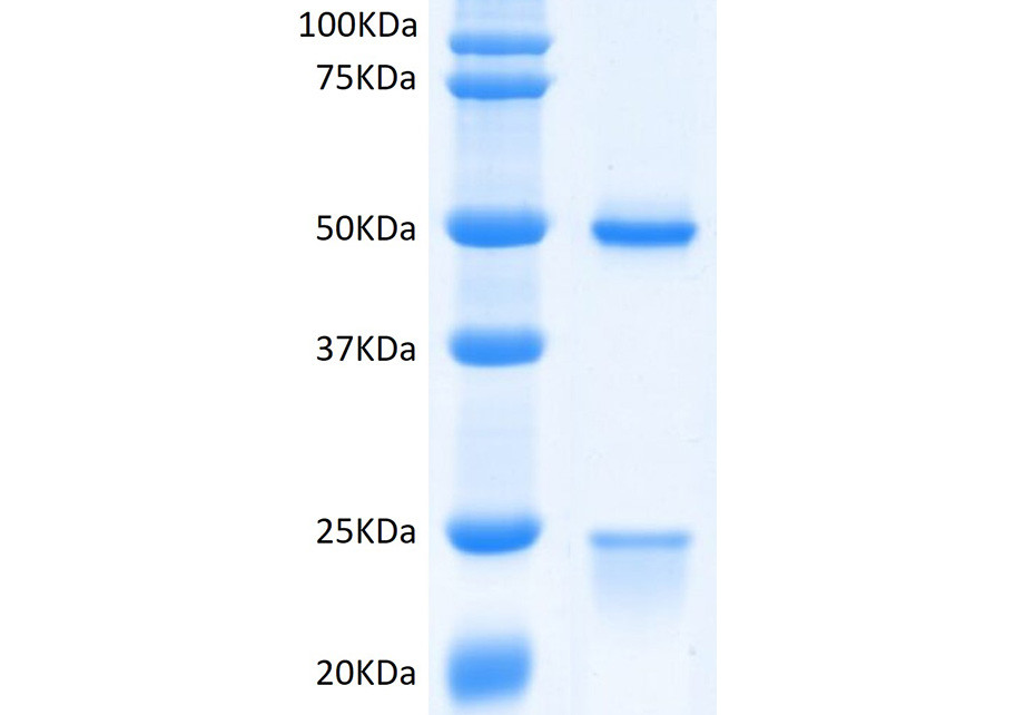 SIRPα (V1&V2&V8&γ) Binding Antibody, Mouse Monoclonal [MA403B-100 or ...