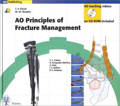 Ao Principles Of Fracture Management Books And Dvd by Thomas Ruedi