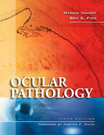 Ocular Pathology - Myron Yanoff