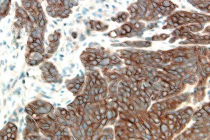 IHC-Tek HRP Anti-Goat Polymer Detection Kit - 10 ml Ready to Use - IHC ...