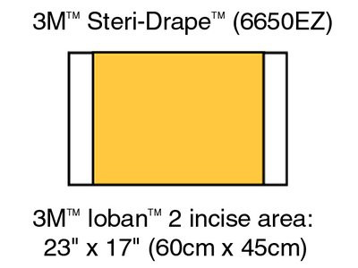 3M Ioban 2 Antimicrobial Incise Drape 6650EZ - USA Medical and Surgical ...