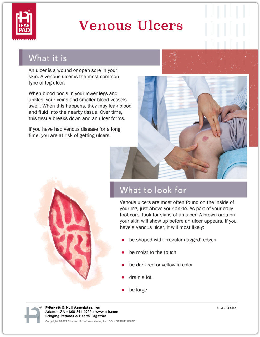 Pvd Venous Ulcers Tearpad 50 Sheets Per Pad Pritchett And Hull