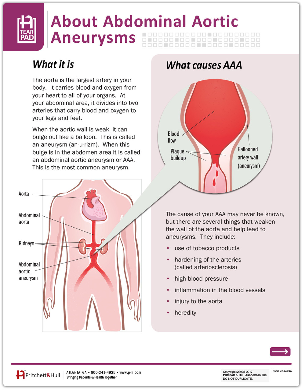 Abdominal Aortic Aneurysm Tearpad 50 Sheets Per Pad Pritchett And Hull