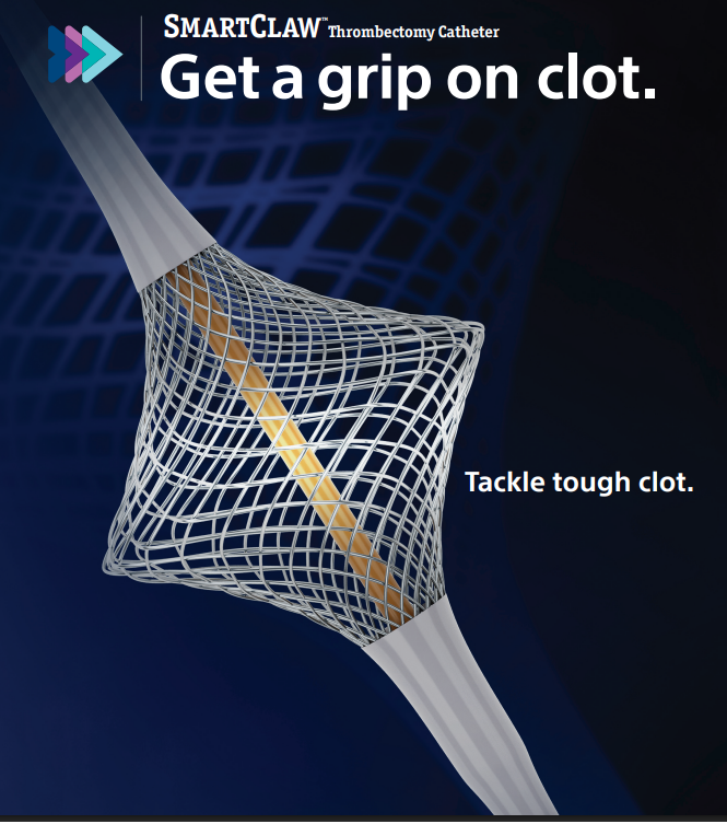 Boston Scientific FD0660-01 SmartClaw™ Thrombectomy Catheter, 8 Fr, 20. ...